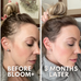 BLOOM+ Hair Growth Revival Serum – Alphaura
