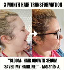 BLOOM+ Hair Growth Revival Serum – Alphaura